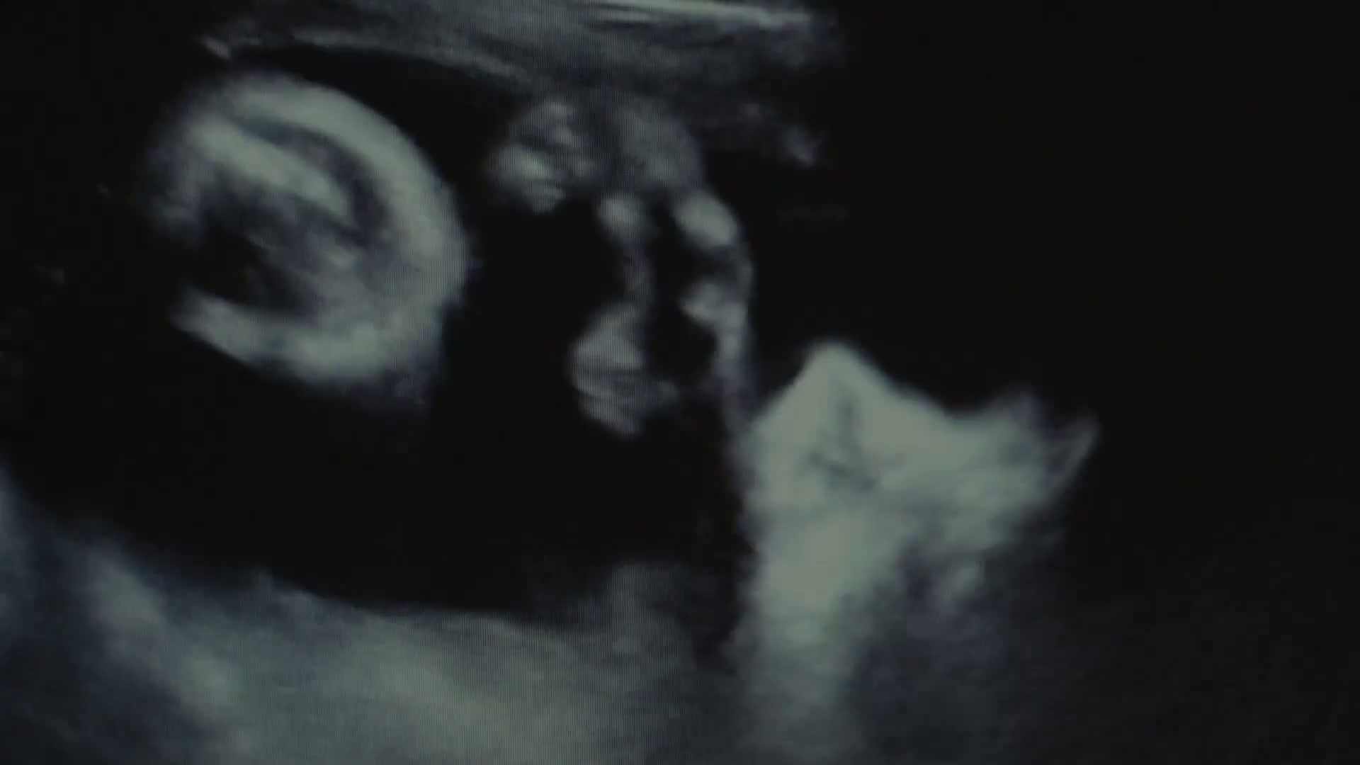 (ultrasound whirring) - Night Is Not Eternal | Clip.Cafe