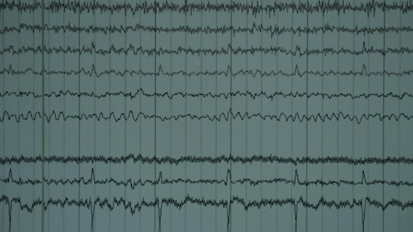 Brain waves are always present {\an8}in our brain. - After Death | Clip ...