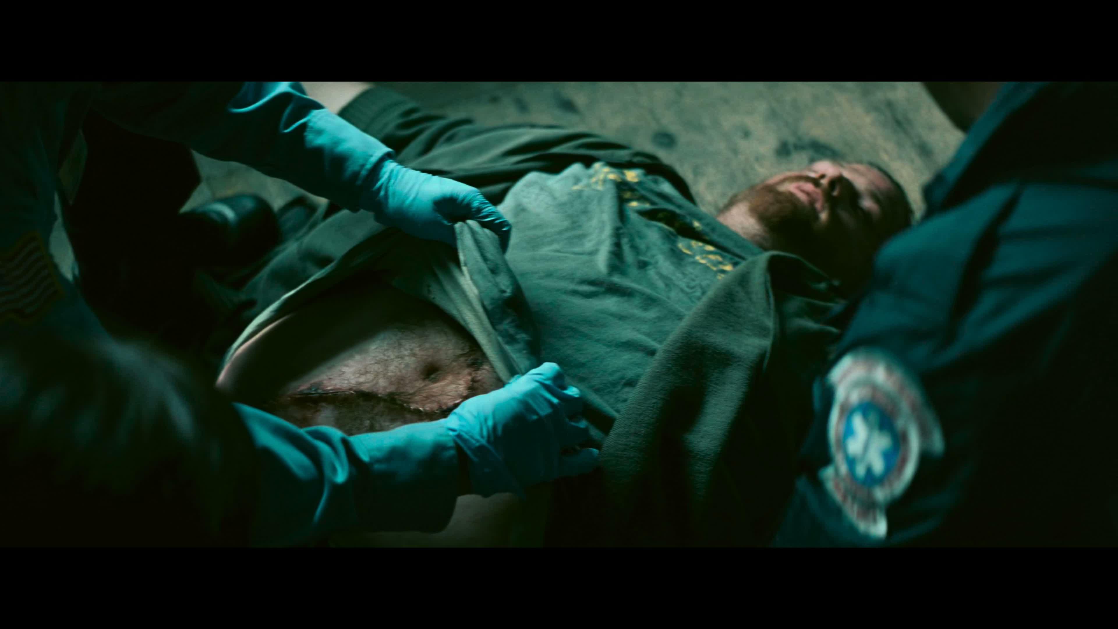 "What's that?Jeez. He's got some kind of a... -...contusion.-I know you ...