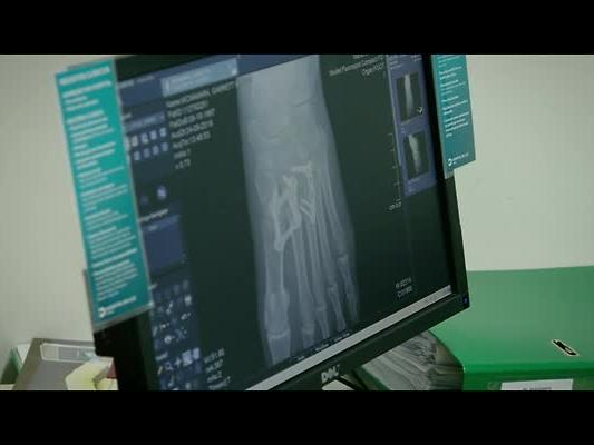 Let's have a look at your X-ray. So everything seems to be okay. He's ...